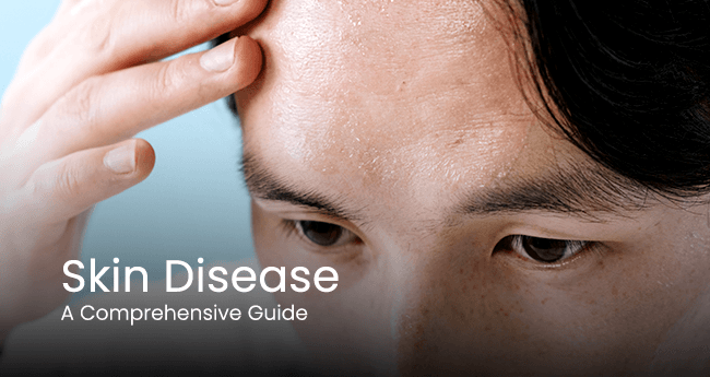Skin Disease - Symptoms, Treatment and Prevention