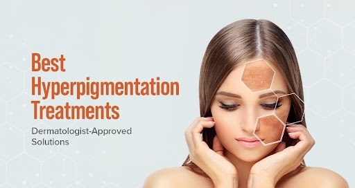 Best Treatments for Hyperpigmentation by Dermatologists