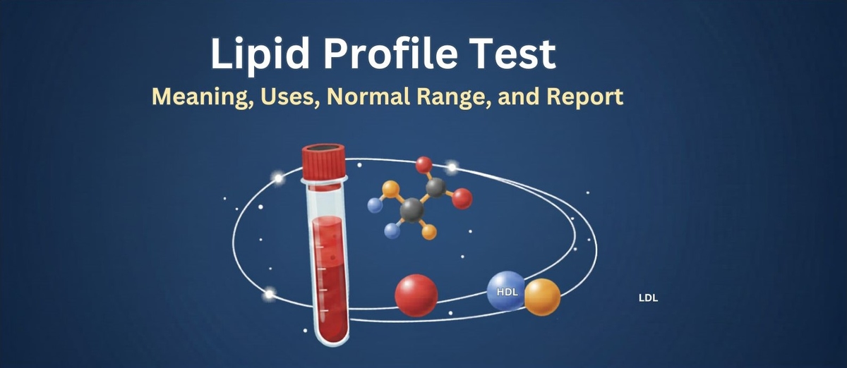 Lipid Profile Test: Meaning, Uses, Normal Range, and Report Interpretation